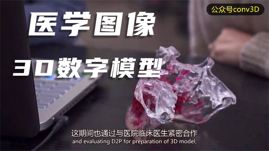 D2P™ 医疗CT三维建模软件 From DICOM-to-PRINT