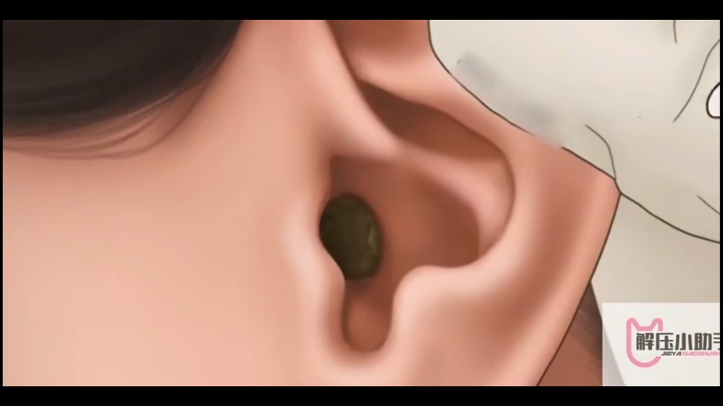 清理耳垢,过程相当的解压。