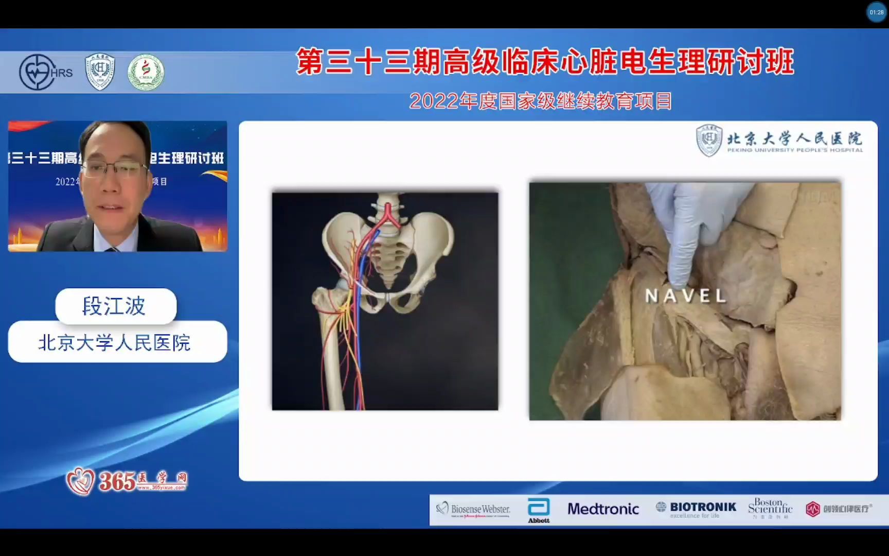 4-123血管穿刺-超声引导穿刺-房间隔穿刺