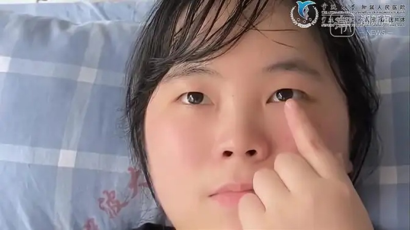 还在往眼球上滴眼药水快来get正确姿势和技巧