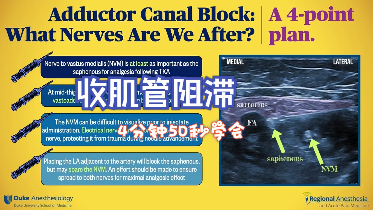 【麻醉技术】超声引导下收肌管阻滞 隐神经 人工慢放 字幕翻译 人工...