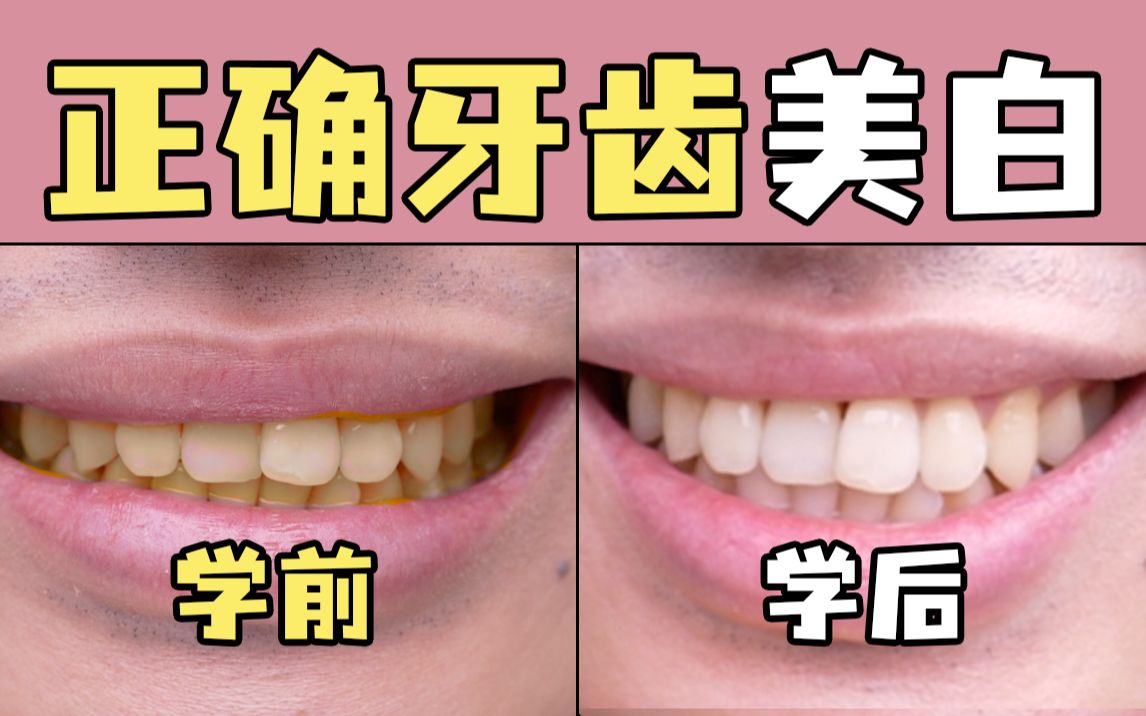 牙齿黄,不敢露齿笑?教你全方位快速get大白牙!|女神进化论