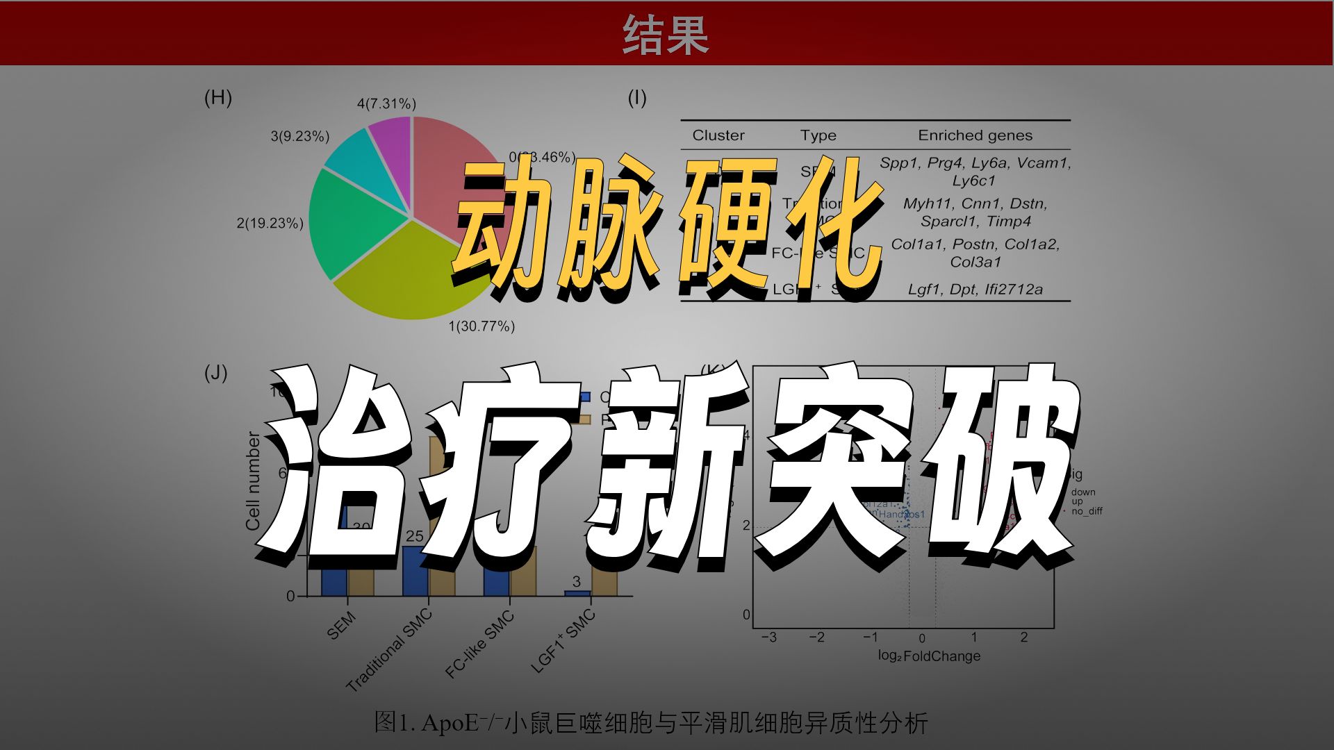 iMetaOmics | 浙江大学陆柏益组-解析动脉粥样硬化过程中泡沫细胞的...