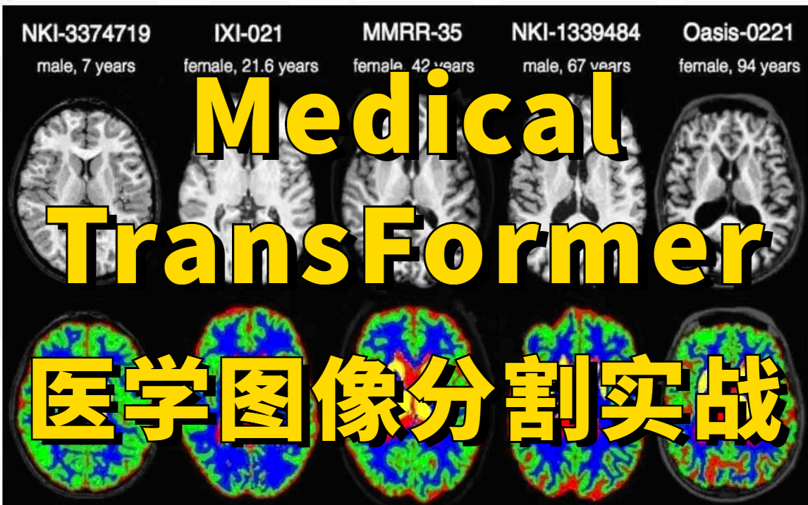 Transformer再下一城!基于Medical TransFormer的医学图像分割实战,...
