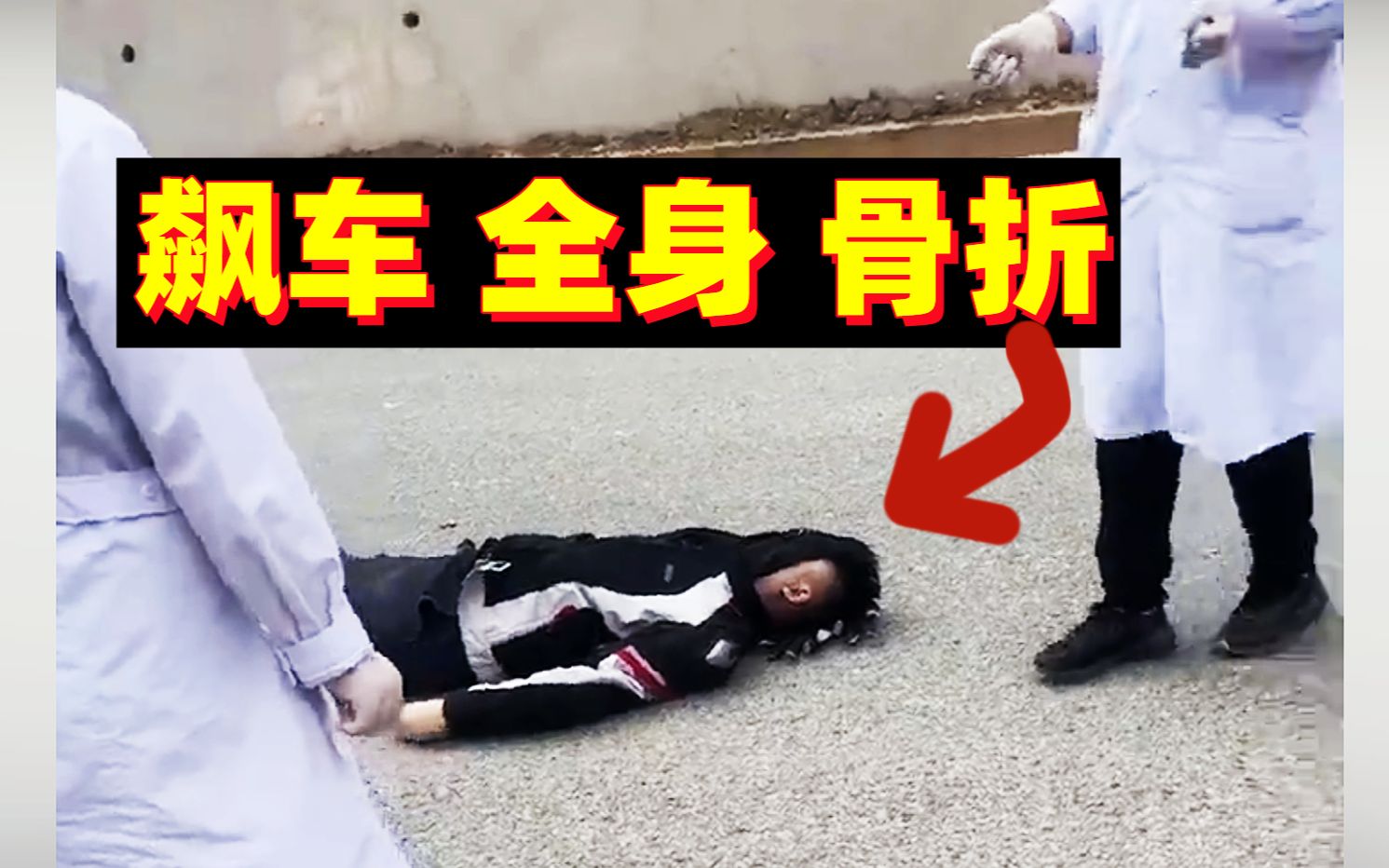 挖槽!骑士时速100KM跑山压弯,一声巨响,人躺了全身骨折,太可怕了!【...