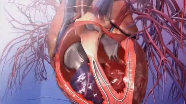 人体解剖37.心瓣膜