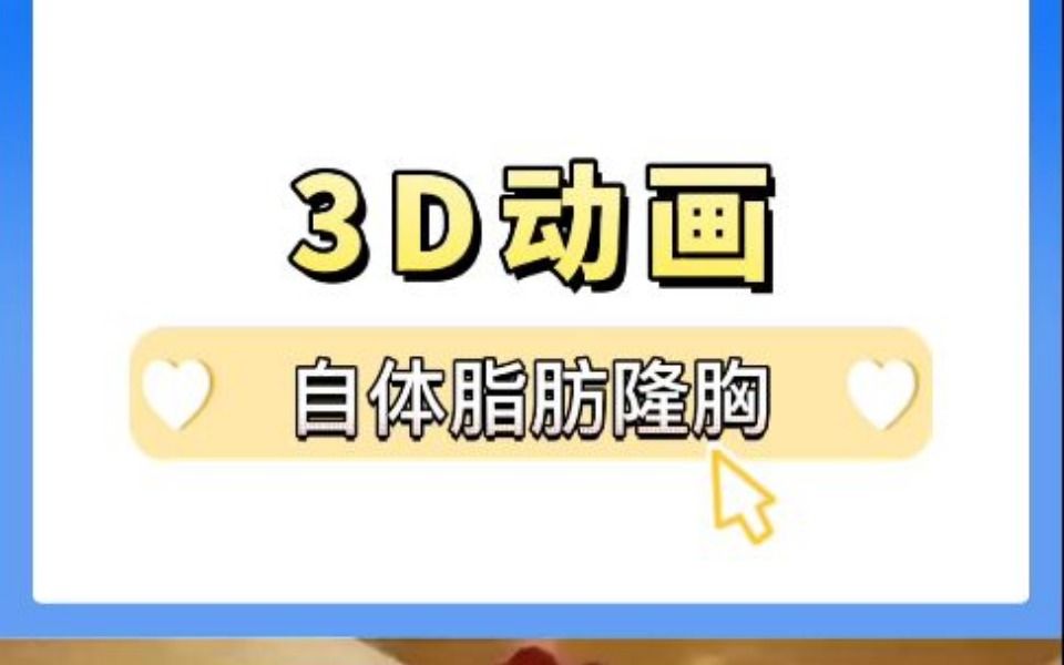3D动画演示:自体脂肪隆胸过程!
