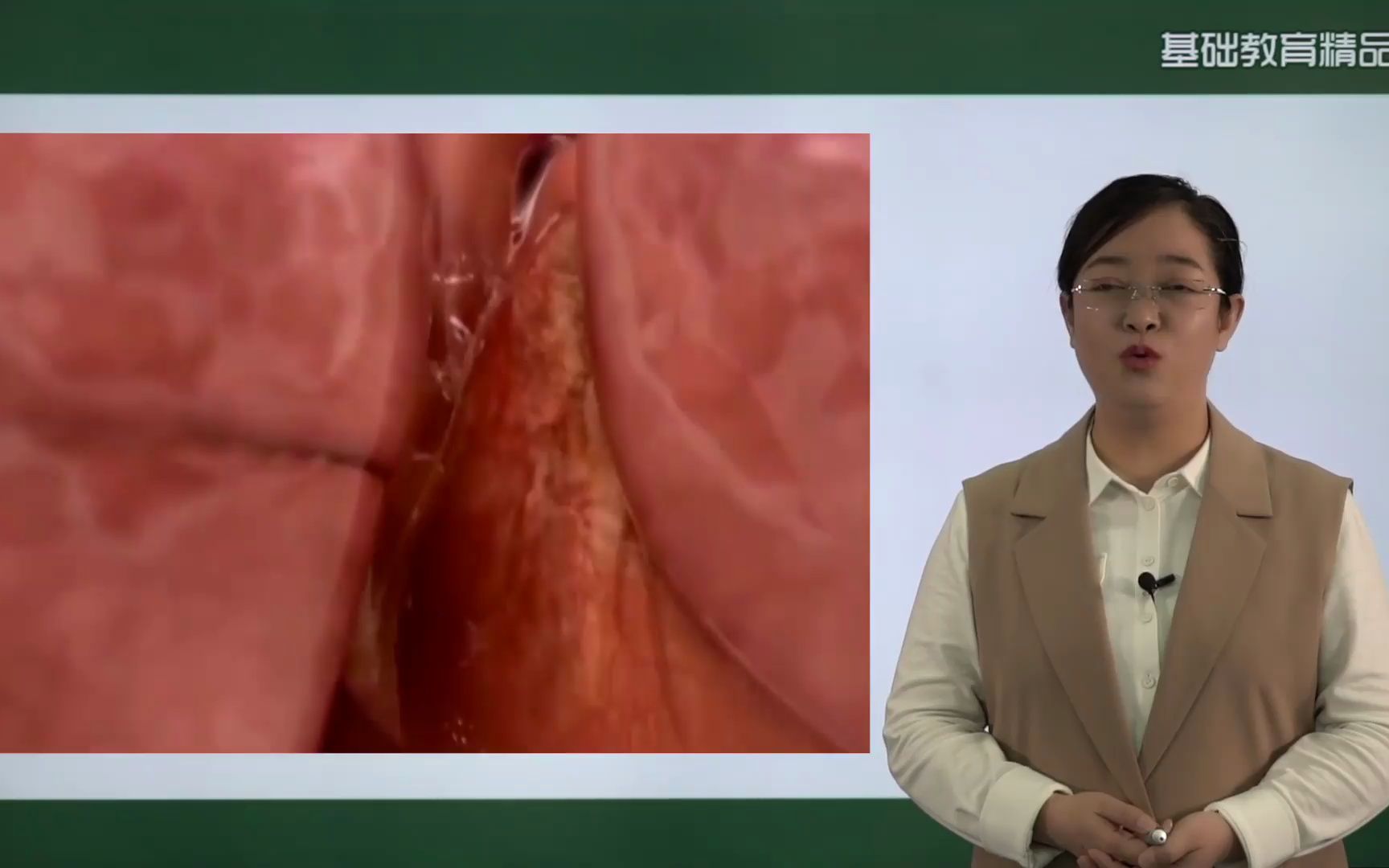 人体内物质的运输(第二课时)血液|苏科版|初中生物|公开课|2022国家...