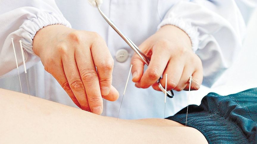 手把手教你针灸正确的操作方式（简单易学）