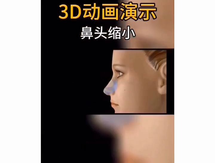 3D动画全程演示【鼻头缩小】