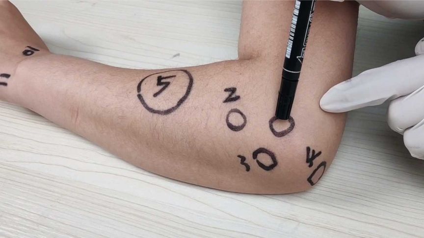 王学昌教授:肘关节疼痛常见7种疾病