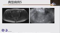 Voluson超声网络课堂: 基于CBL、PBL的超声教学大查房_batch