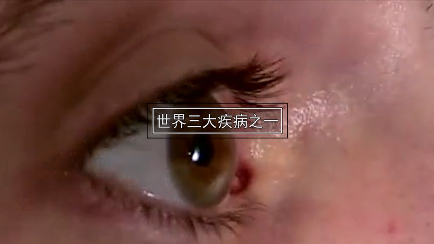 世界三大疾病之一,中国33%的发病率,你是否也有