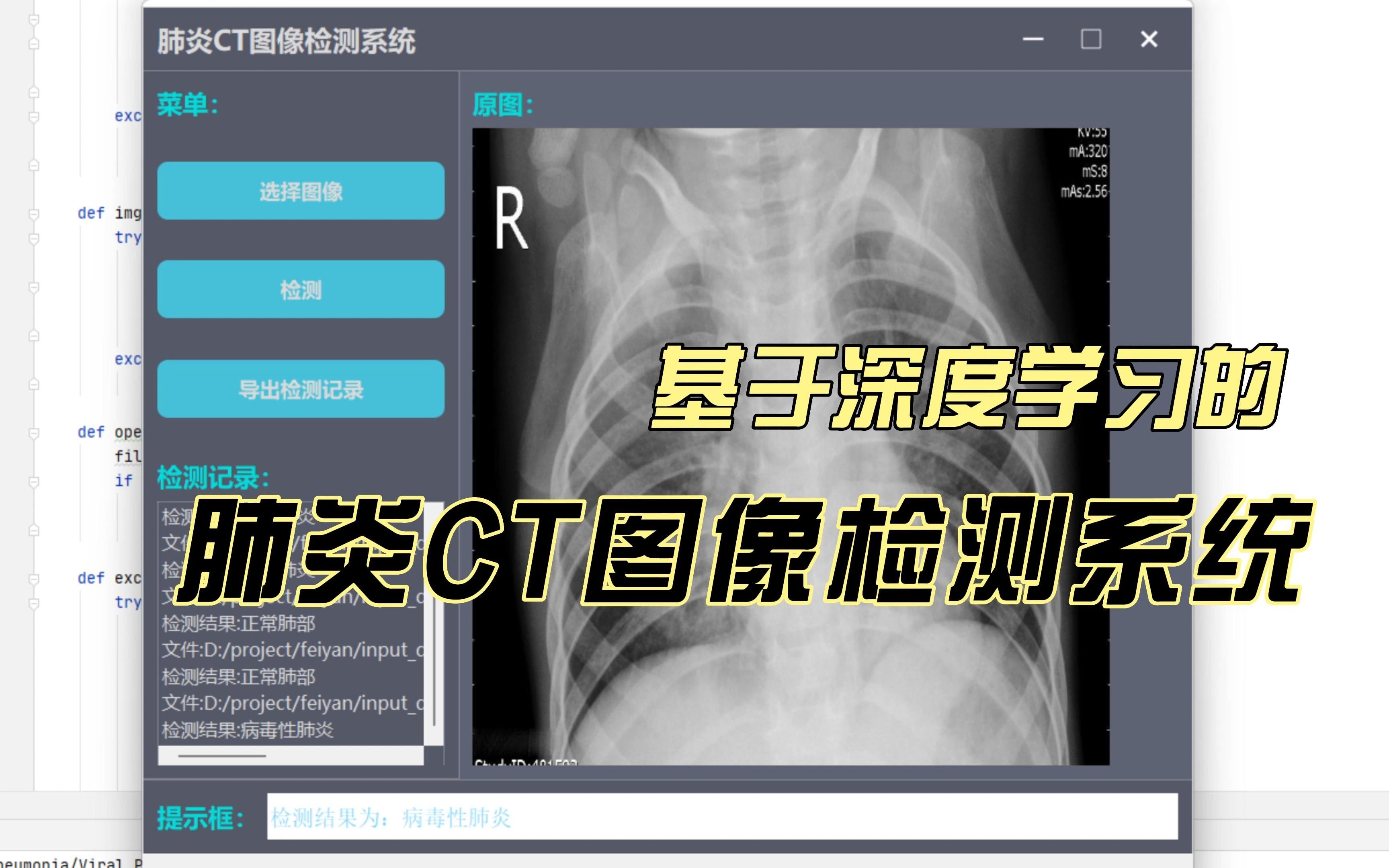 基于深度学习的肺炎CT图像检测系统(完整源码 教程 部署 数据集 Res...