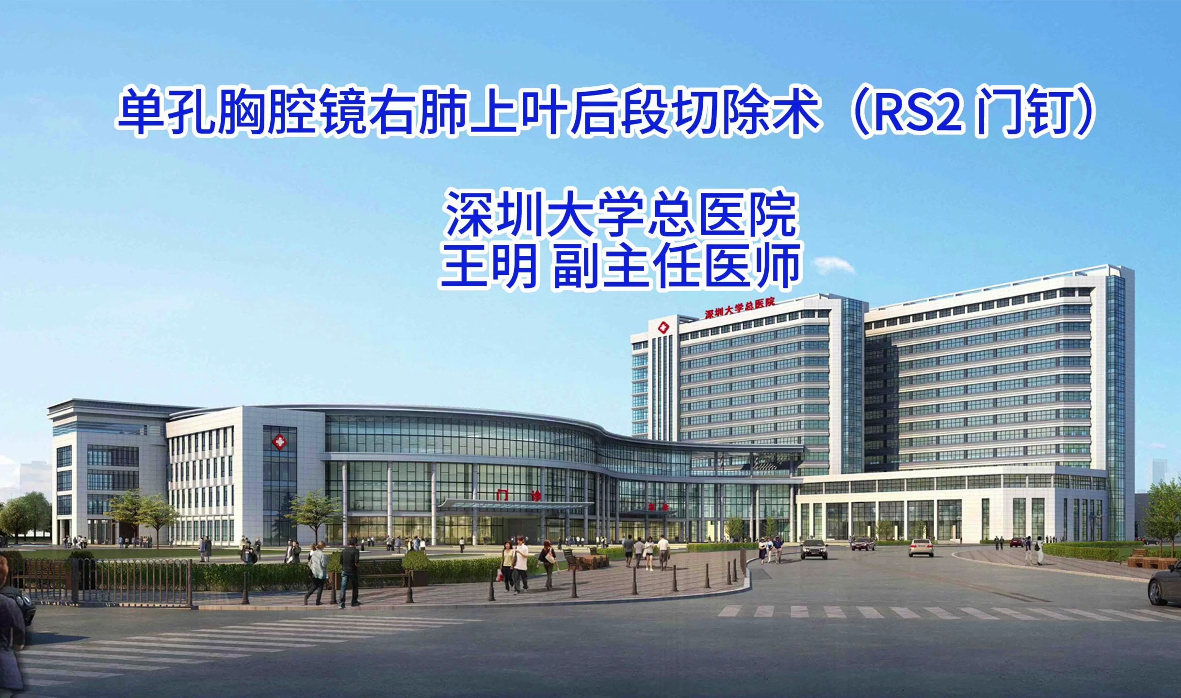 单孔胸腔镜右肺上叶后段切除术(RS2 门钉淋巴结)王明教授供稿