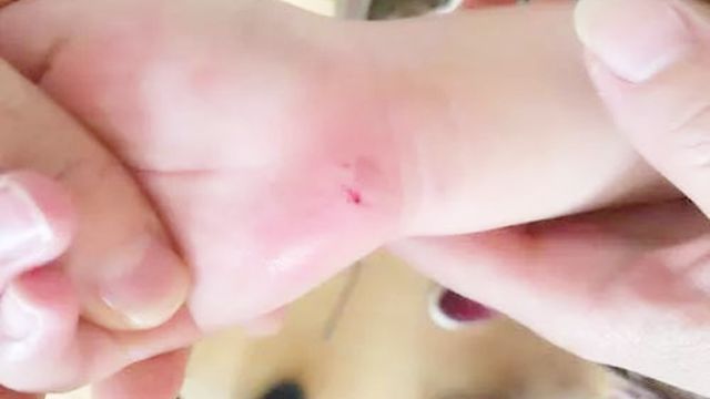 4岁孩子在学校一天咬伤5人,孩子爸爸却说是幼儿园的责任!