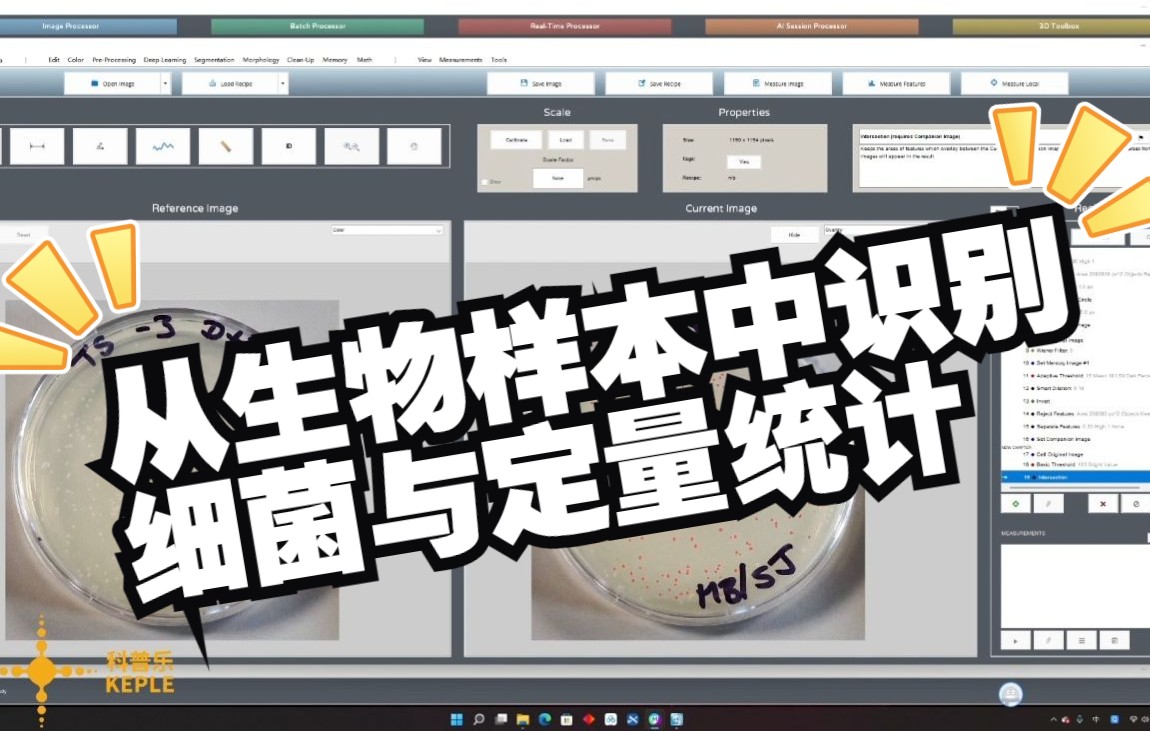 MIPAR第12期:从生物样本中识别细菌与定量统计