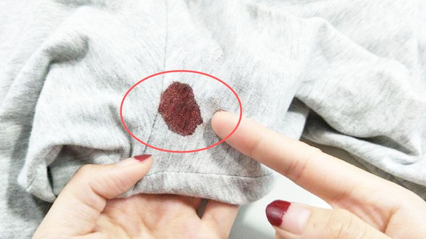 衣服顽固血渍洗不掉?用它一搓就掉,不留一丝痕迹,立马焕然一新