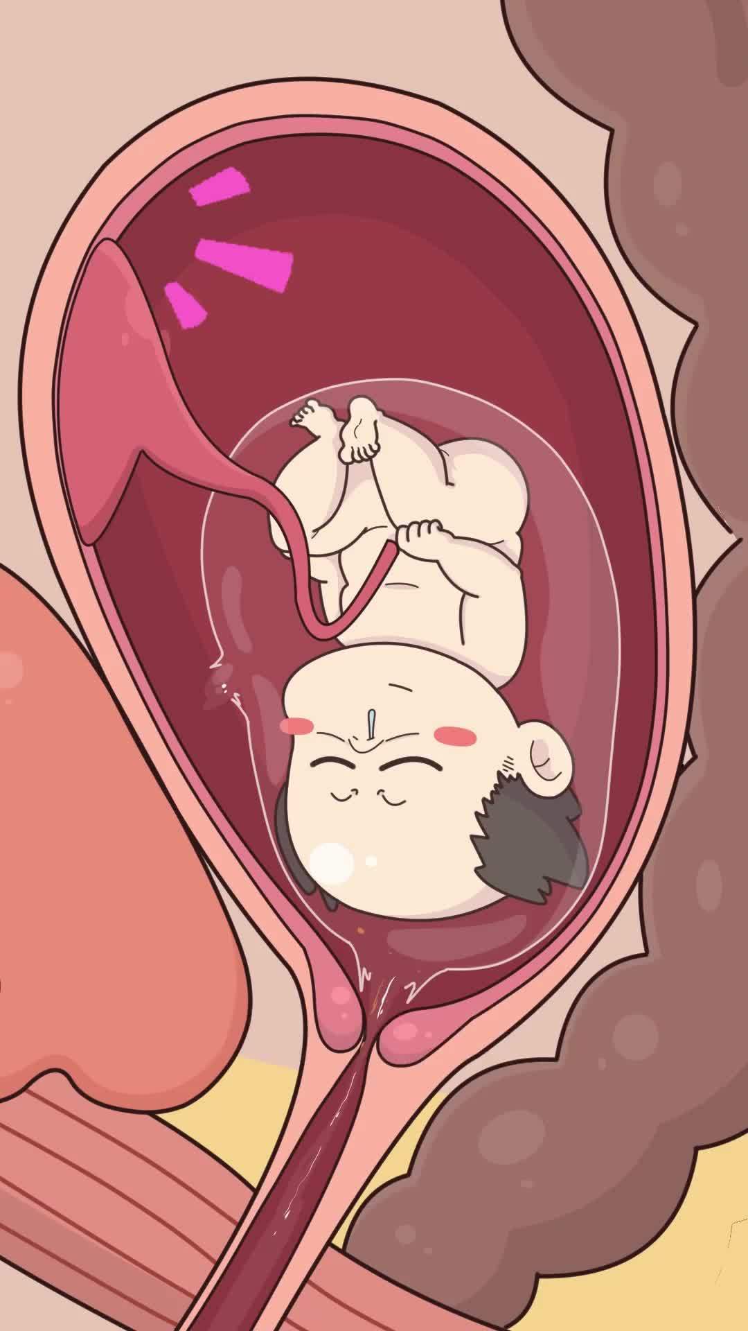 羊水栓塞究竟有多凶险?