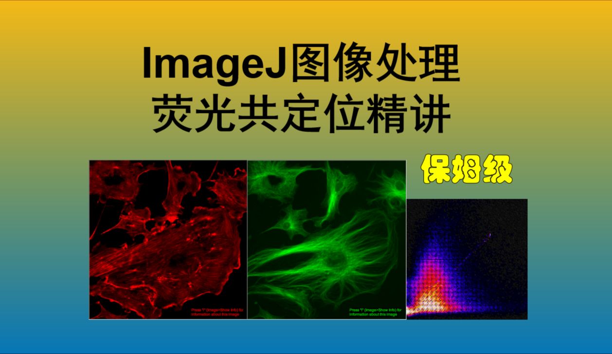 『超实用』ImageJ图像处理 - 荧光共定位分析Colocolization_finder