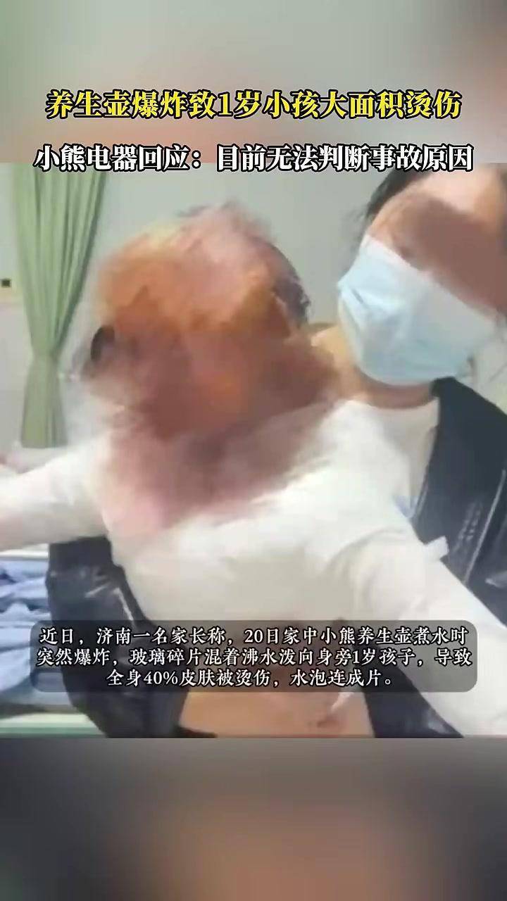 养生壶爆炸致1岁小孩大面积烫伤!小熊电器称目前无法判断事故原因,有...