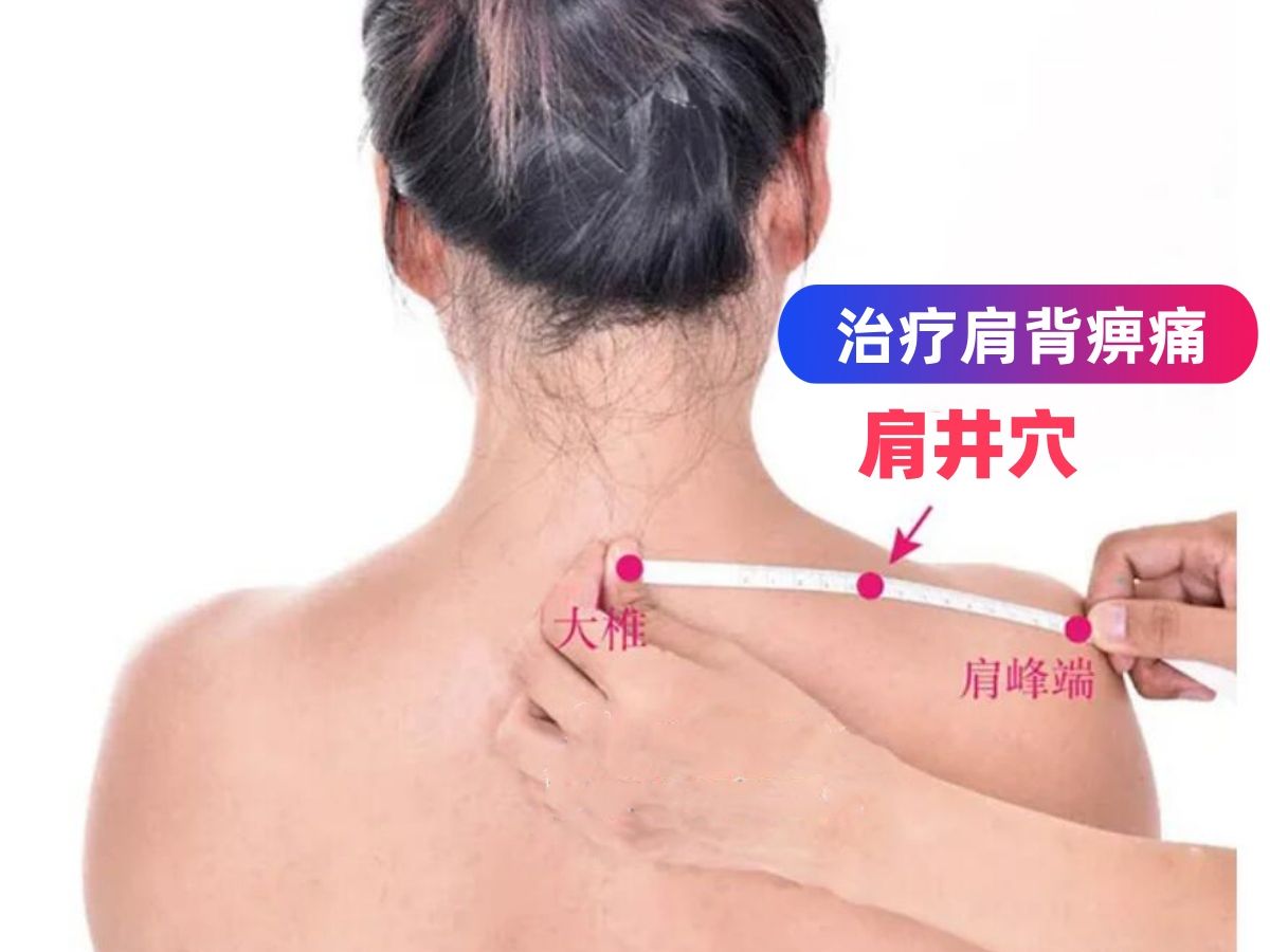 178、足少阳胆经 — 肩井穴 — 治疗肩背痹痛