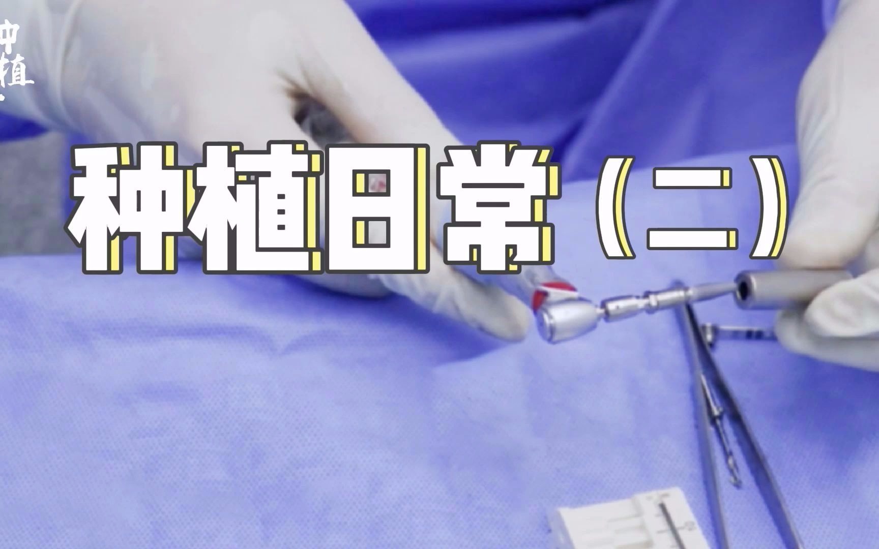 种植日常—放种植体以及制作临时固定义齿