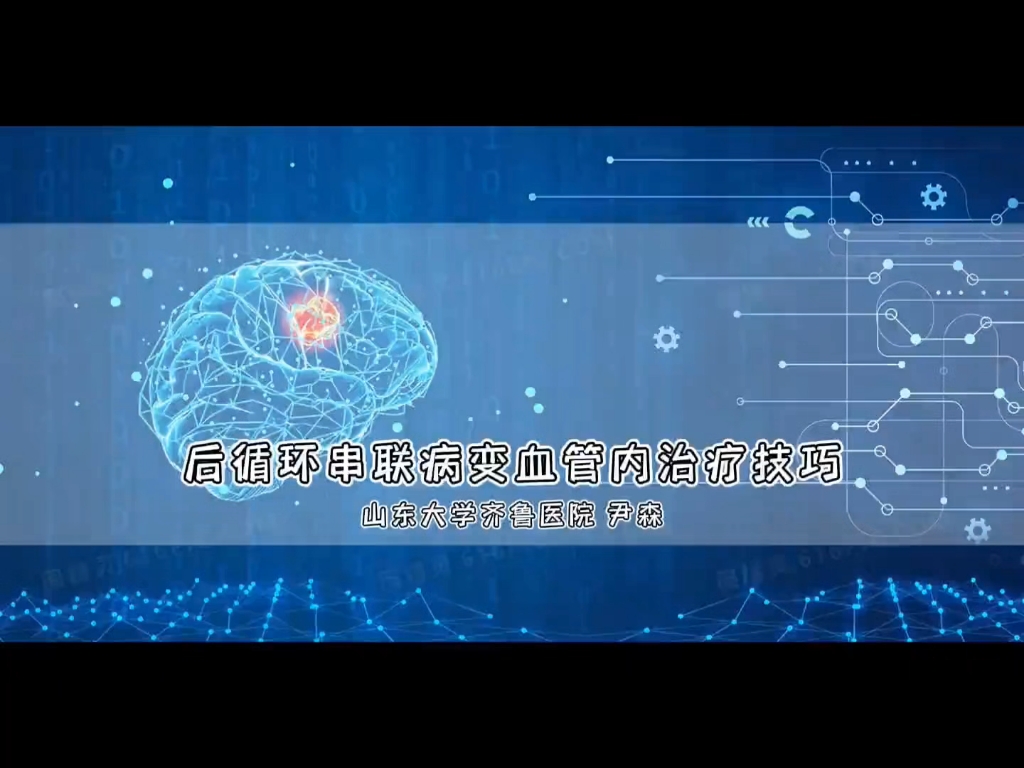 脑血管造影—介入全流程实操讲解:后循环串联病变血管内治疗技巧