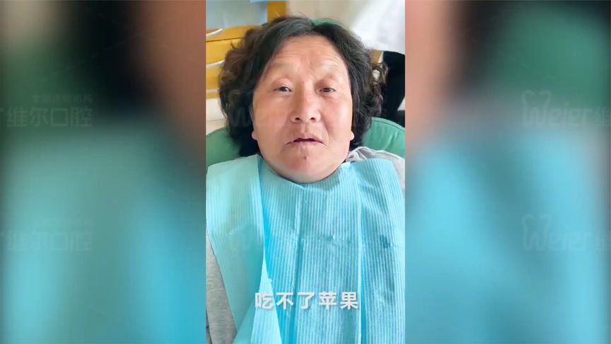 66岁,缺牙10多年,全口无牙颌,高难度穿颧穿翼种植,当天啃苹果
