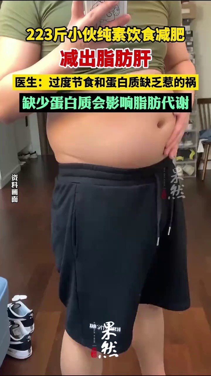 223斤小伙纯素饮食减肥减出脂肪肝 医生:过度节食和蛋白质 缺失