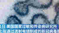 它原来长这样?美国公布新冠病毒电镜图