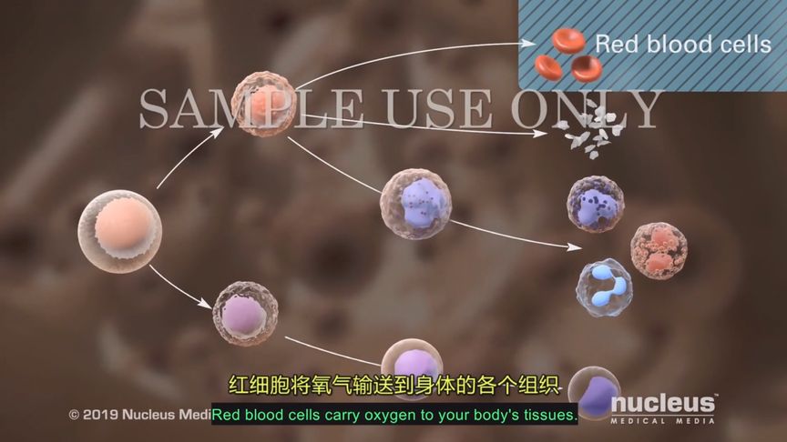 3D医学视频:认识“白血病”(原版英文+中英双字幕)