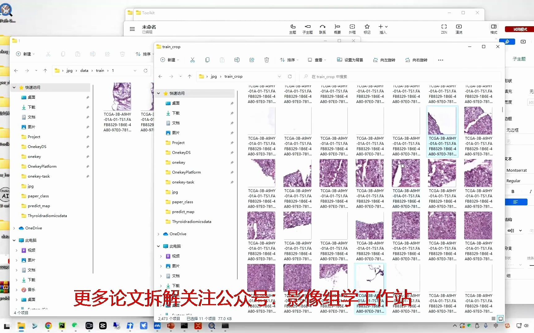 通过影像组学工具如何快速实现肾癌最优模型数据标注