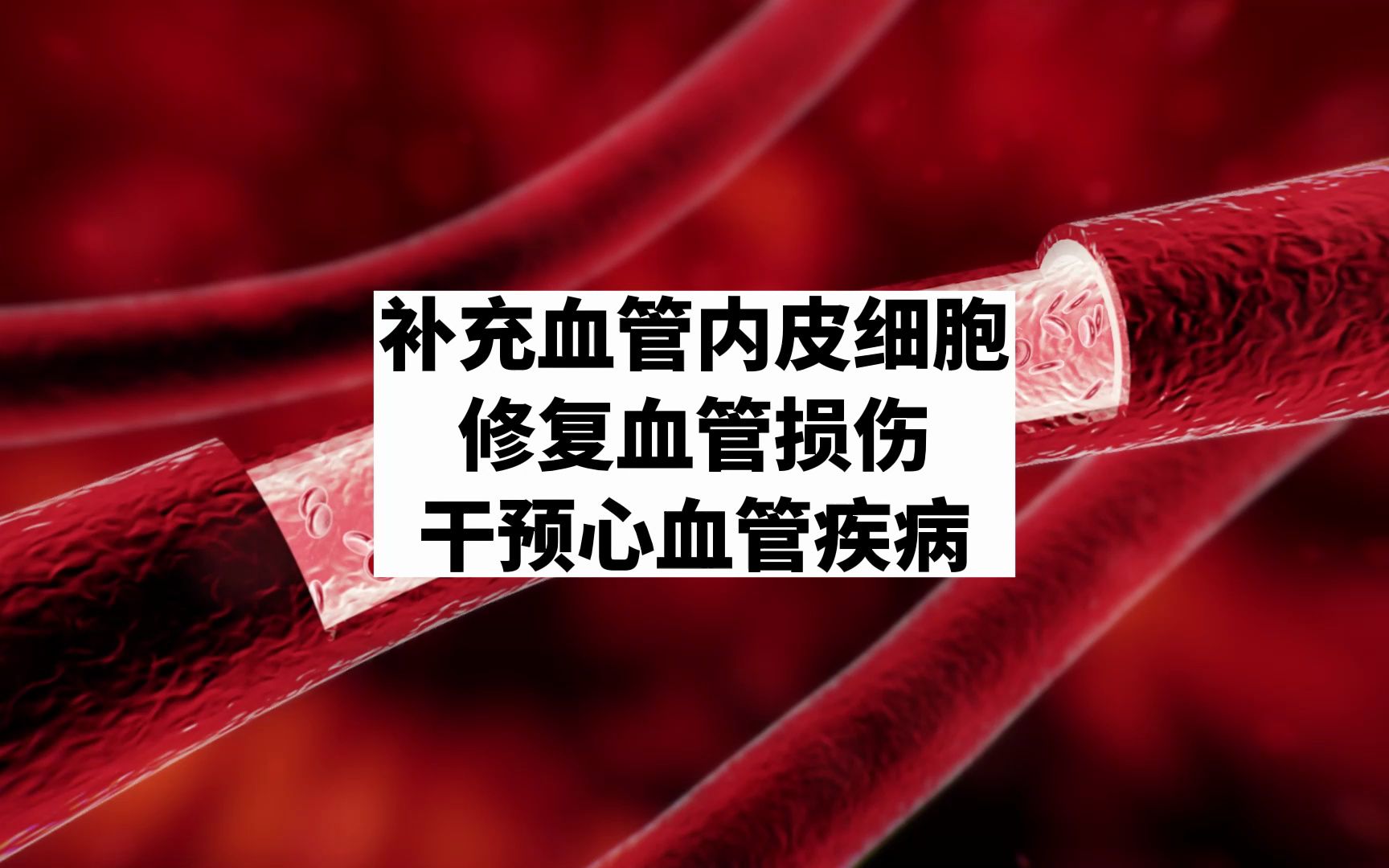 补充血管内皮细胞修复血管损伤,干预心血管疾病