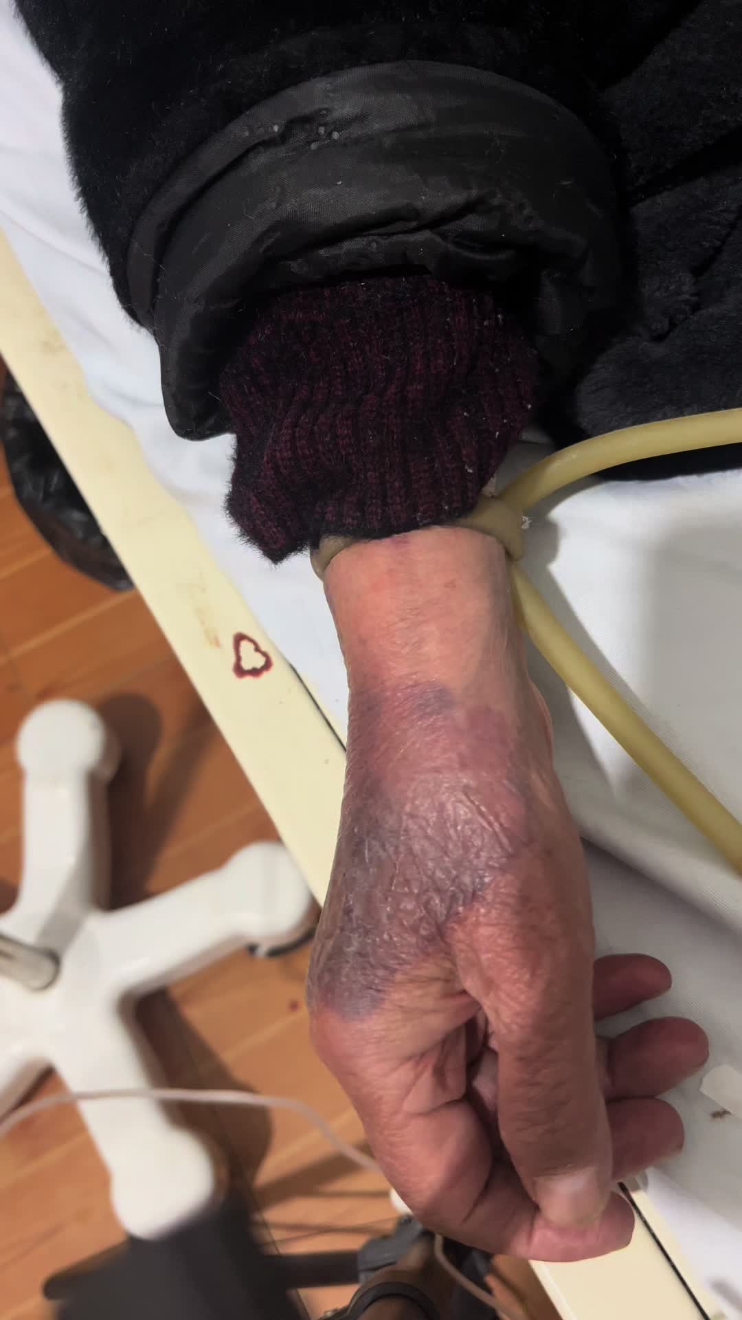 拿留置针的方式有很多,新手我比较推荐这种 #留置针 #护士懂护士 #...