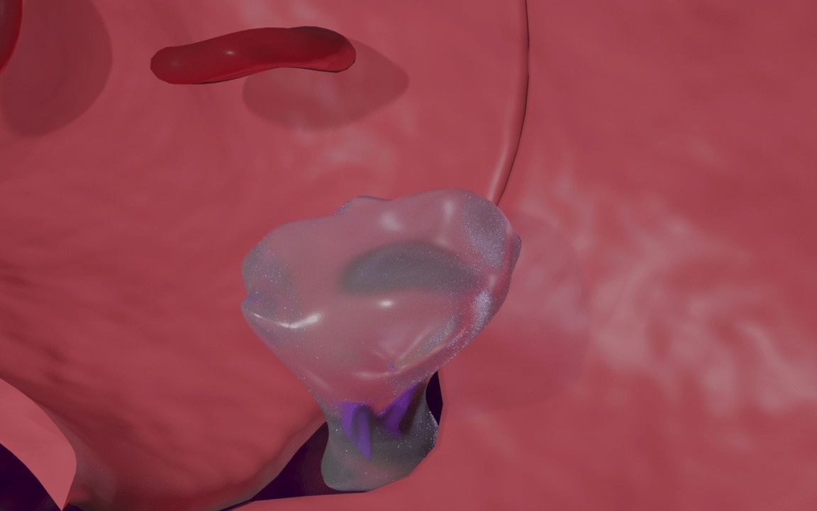 白细胞渗出-医学动画