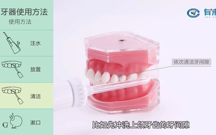口腔科普 | 冲牙器的使用方法