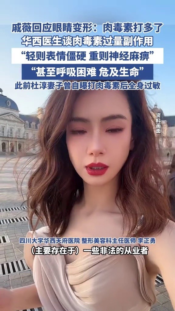 医生谈戚薇"眼睛变形":警惕肉毒毒素中毒! #戚薇 #肉毒毒素中毒 #肉毒 ...