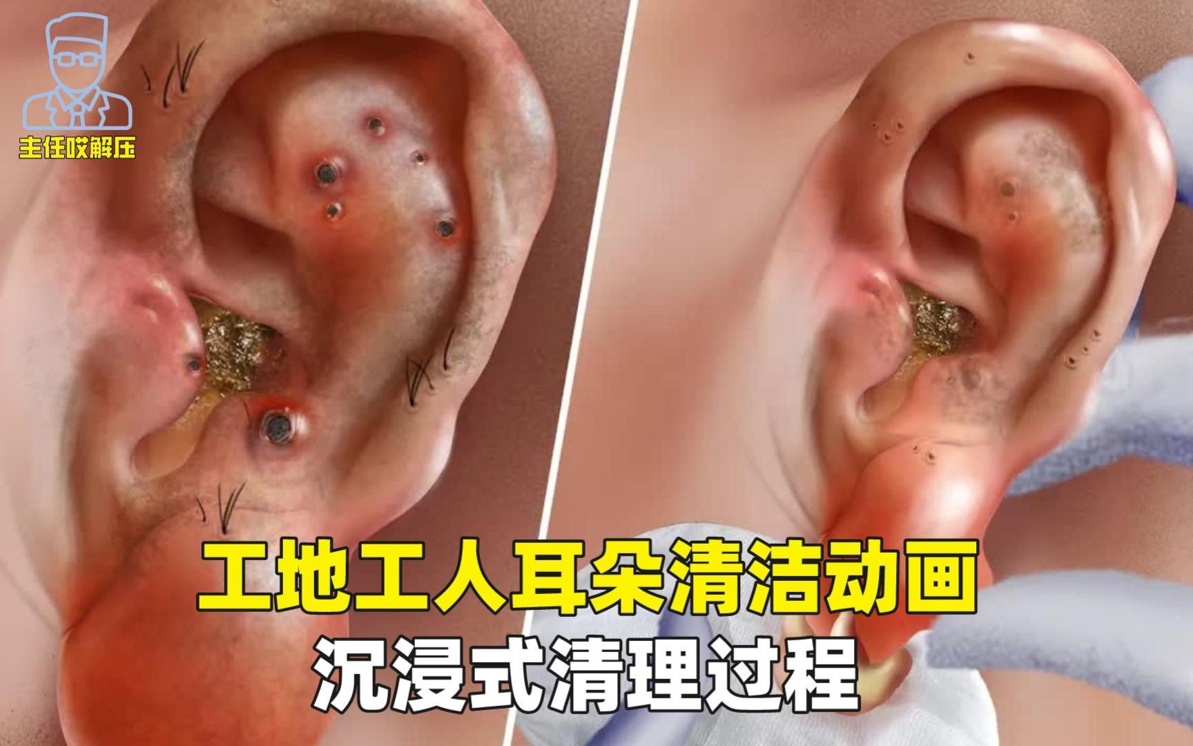解压动画,工地工人耳朵清洁动画,沉浸式清理过程
