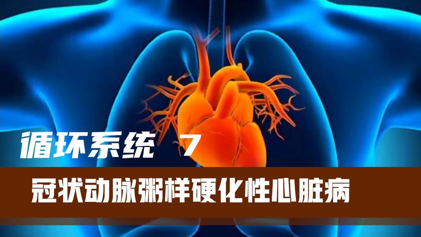 什么是冠心病?为什么是粥样硬化?怎样预防?知识点,赶紧收藏!