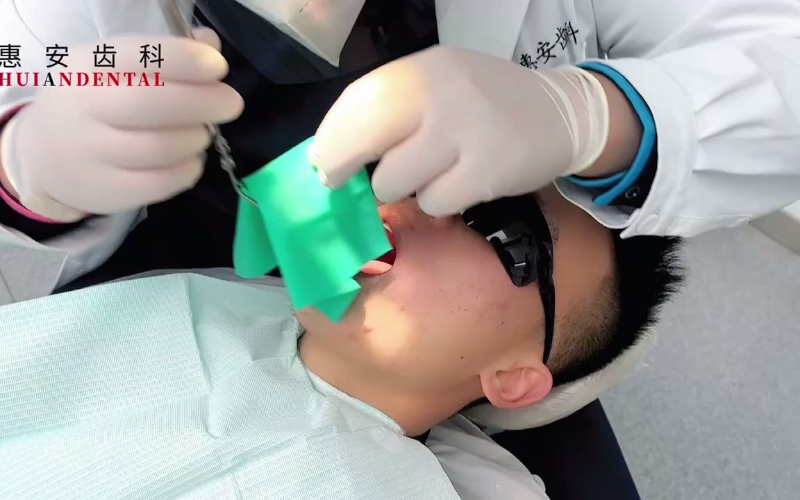 如何安全看牙——橡皮障的作用!#惠安齿科