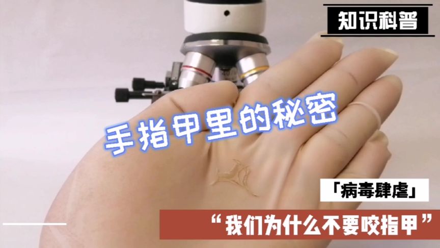 马上闭上你的嘴吧!一克的指甲里面有35亿个细菌你还咬指甲装嫩吗
