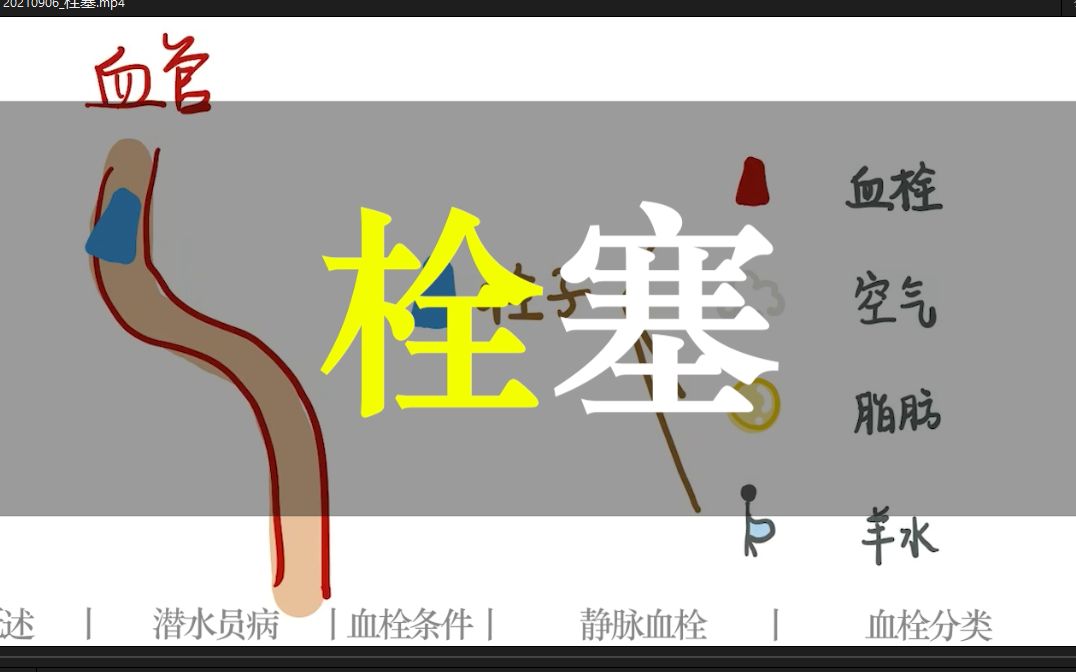 【病理三分钟】栓塞:血栓是怎么形成的?潜水员病是什么?白色血栓...