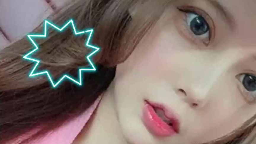 拉皮手术的弊端看过来!拉皮术后创伤大、疤痕怎么办?