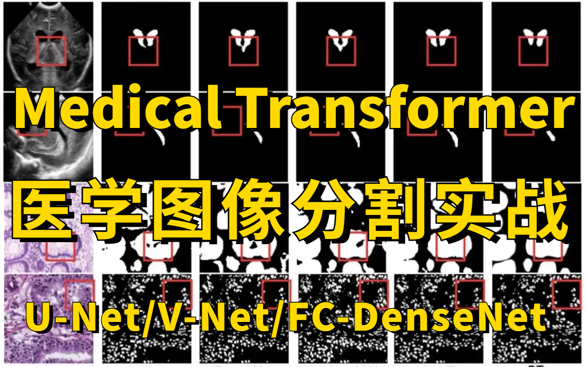 ...跨界CV做分割:基于Medical Transformer的医学图像分割实战教程,U-...
