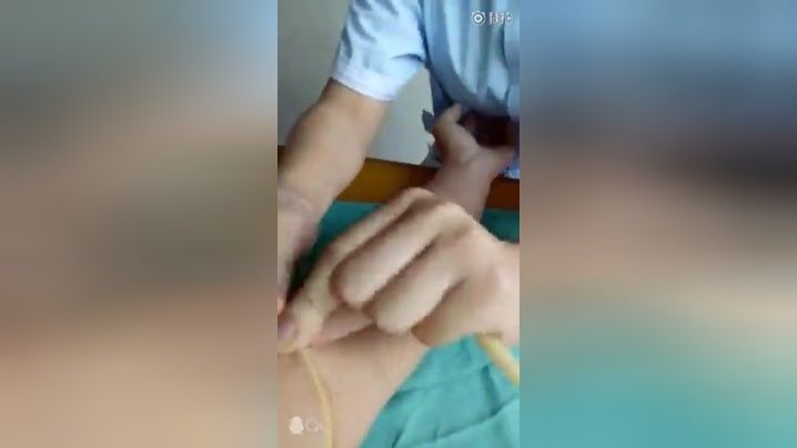 在医疗中,那根管子叫止血带,又叫压脉带!