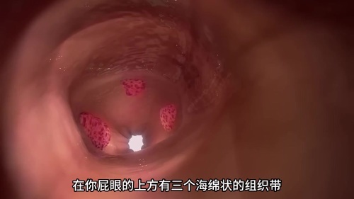 痔疮是如何形成的,内痔和外痔又有什么区别?科普科普知识科普一下...