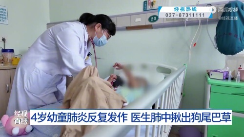 4岁幼童肺炎反复发作医生肺中揪出狗尾巴草