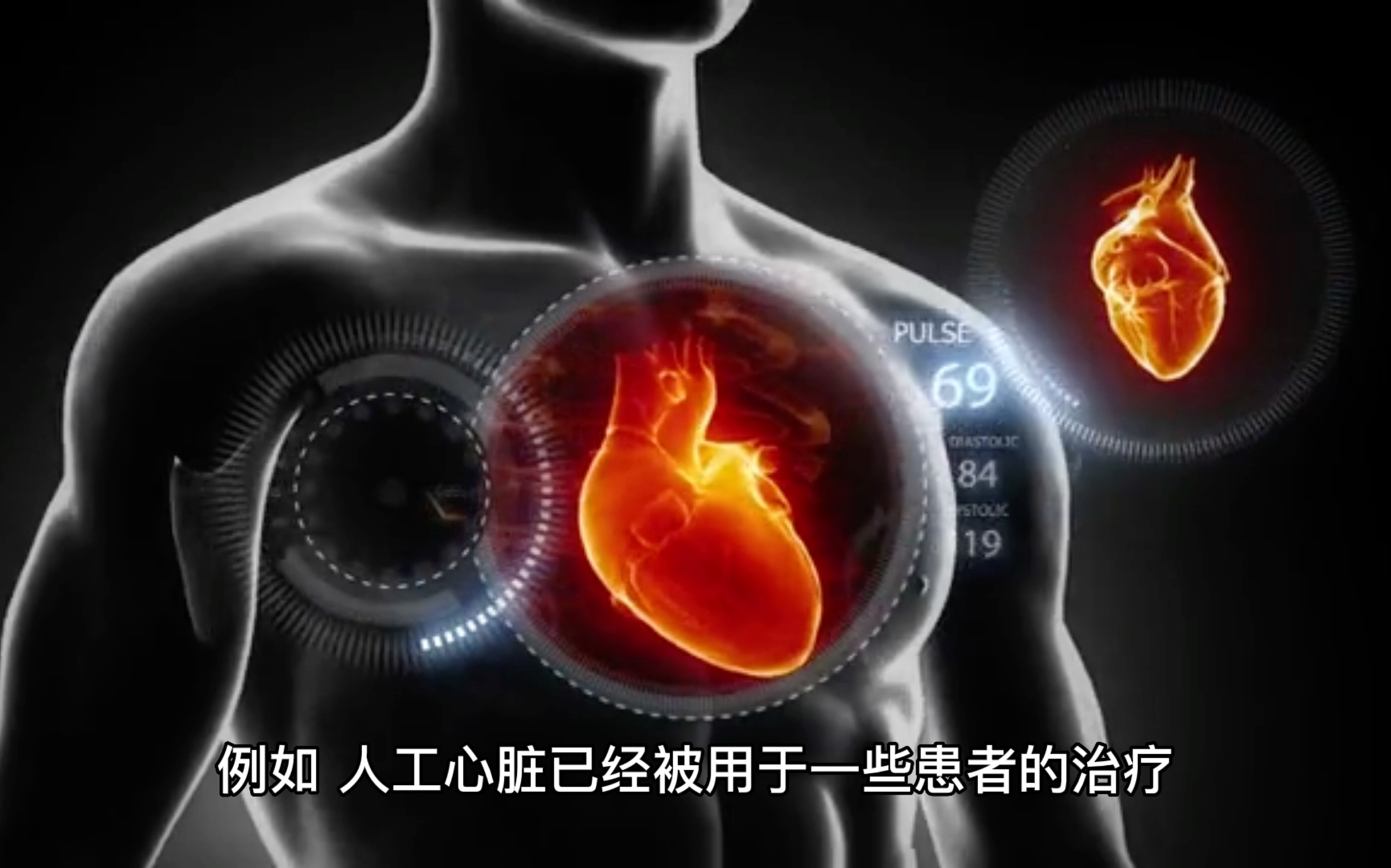 2023年度突破:让移植器官短缺成为过去