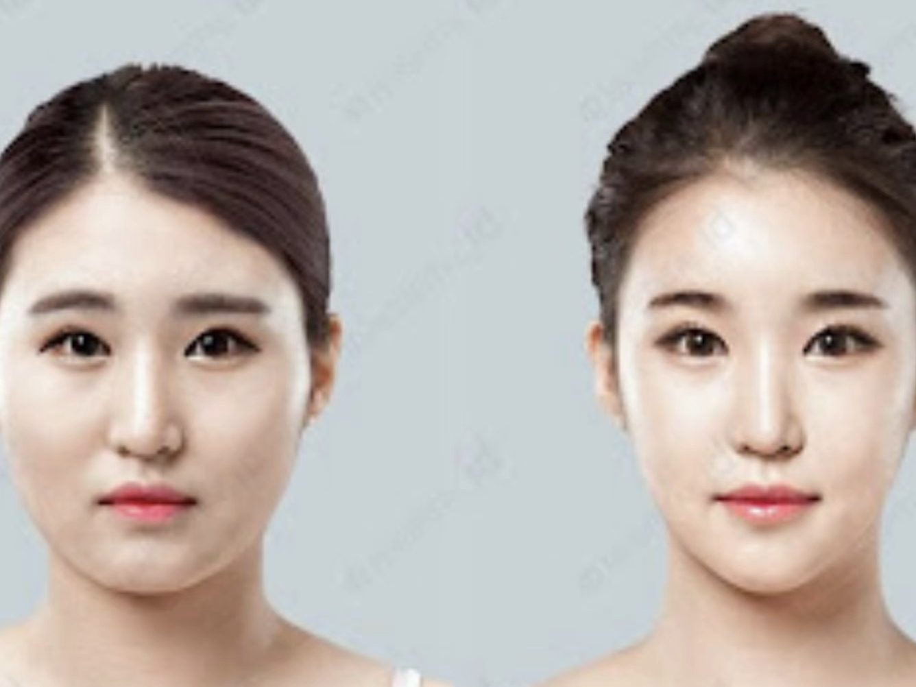 ...分享/极端外貌转变 生物黑客整形 手术级别 含极快速度物理显化推注器